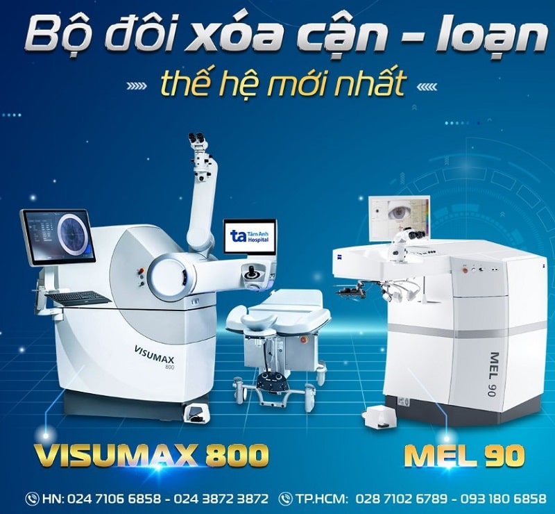 Mổ cận được mấy lần? Lưu ý gì khi mổ cận lần 2?