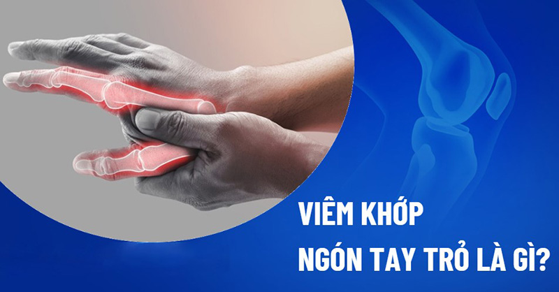 Viêm khớp ngón tay trỏ: Nguyên nhân, dấu hiệu và cách cải thiện