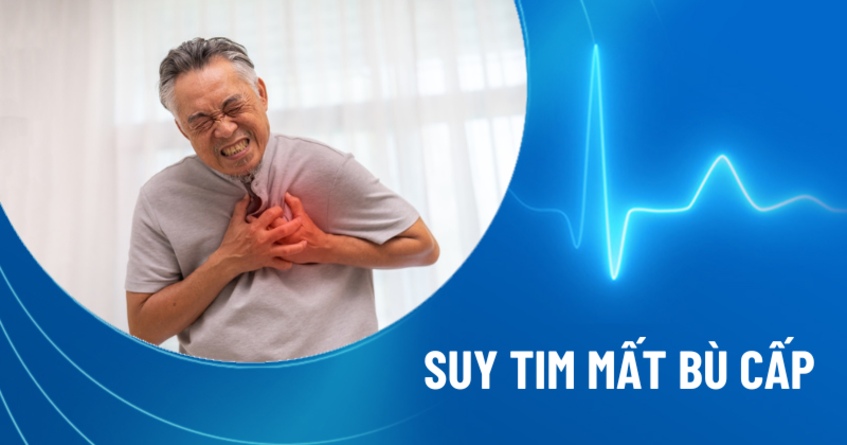 Suy tim mất bù cấp tính: Triệu chứng nguy hiểm và cách điều trị