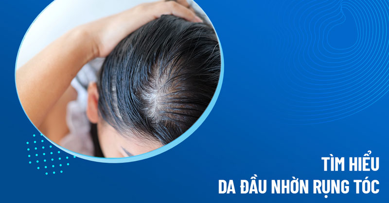 Cách gội đầu đúng cách với 7 bước để không bị rụng tóc mà sạch thoáng