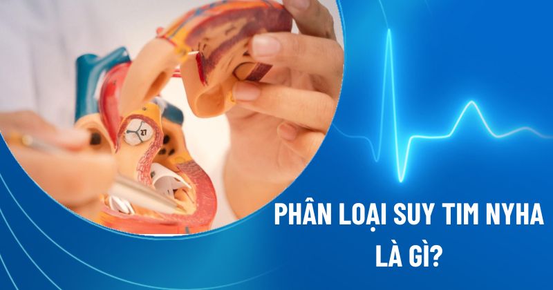 Phân loại suy tim theo NYHA là gì? Tiêu chuẩn chẩn đoán bệnh