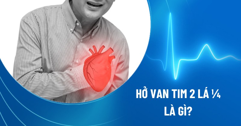 Hở van tim 2 lá: Nguyên nhân, triệu chứng và phân loại mức độ