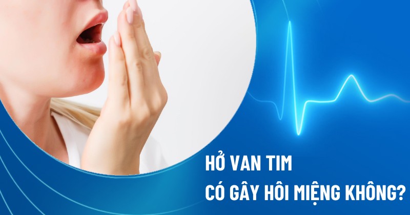 Hở van tim 3 lá: Nguyên nhân, dấu hiệu và các mức độ bệnh
