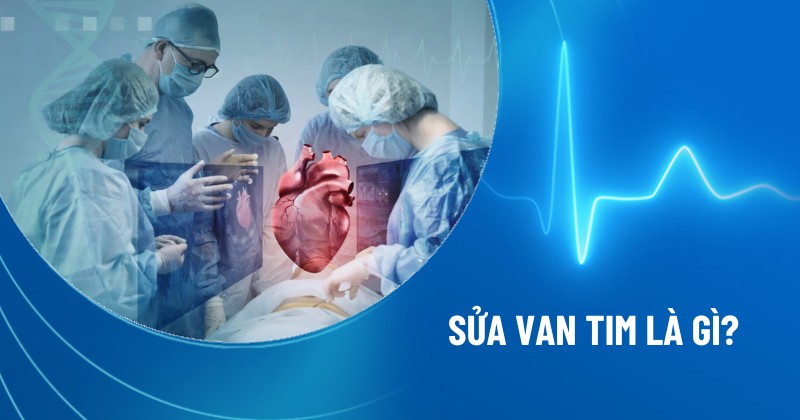 Phẫu thuật sửa van tim: Quy trình thực hiện và lưu ý sau mổ