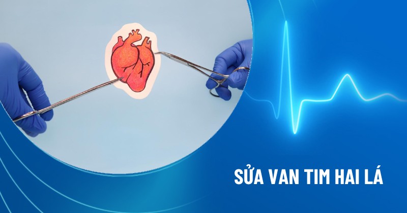 Hở van tim 3 lá: Nguyên nhân, dấu hiệu và các mức độ bệnh