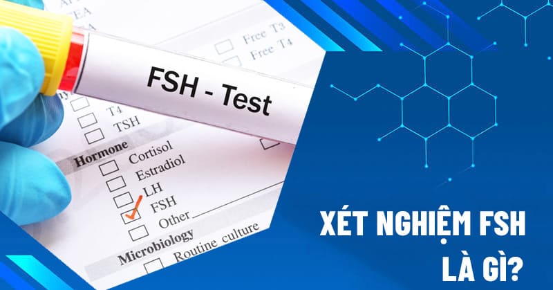 Xét nghiệm FSH là gì? Quy trình xét nghiệm như thế nào?